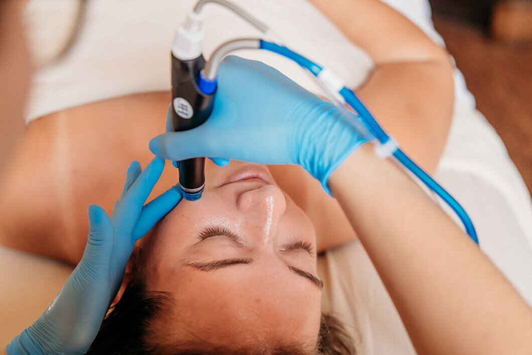 Why HydraFacial is the Ultimate Skincare Treatment